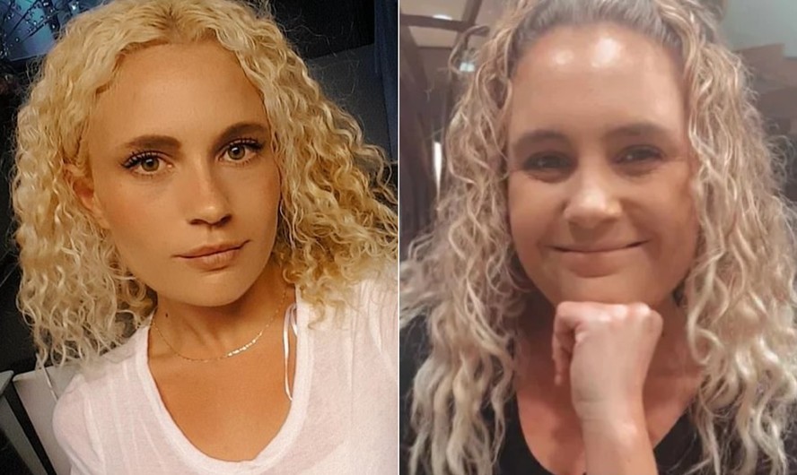 Mulher morre após ser infectada por superbactéria que corrói órgãos ...