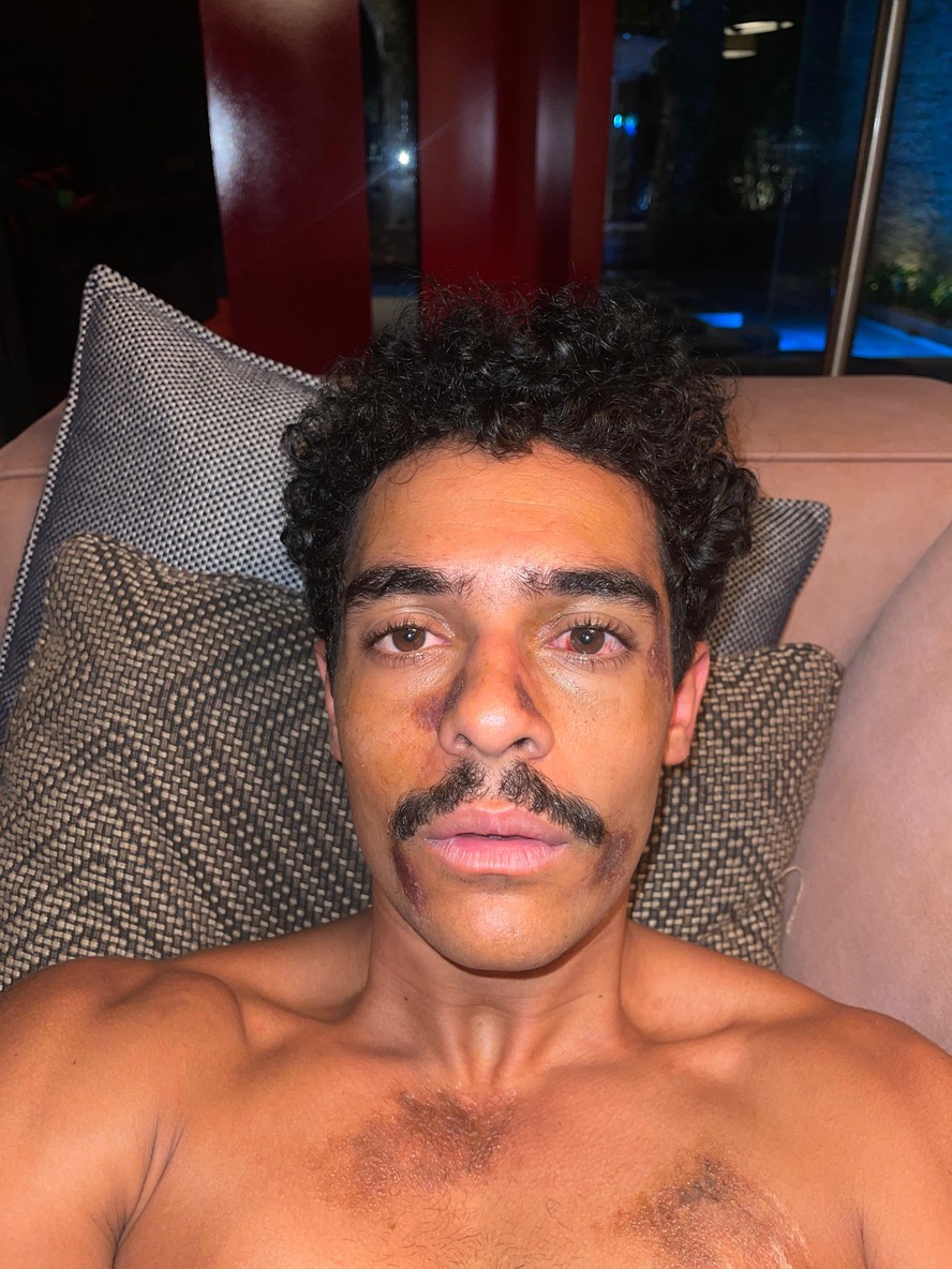 Igor Fernandez surgirá com menos dez quilos no capítulo final de ...