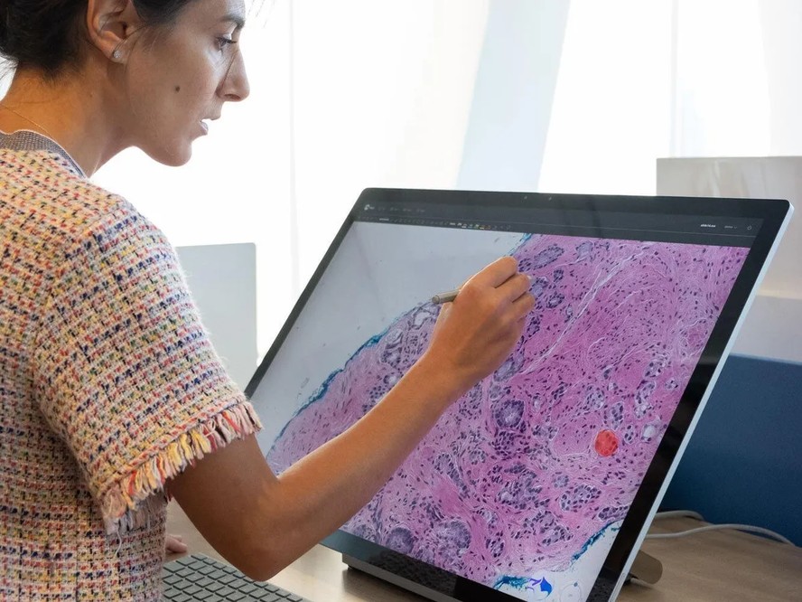 Uso de inteligência artificial no combate ao câncer já chega ao paciente