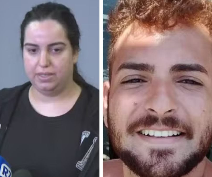Peeling de fenol: Paciente da mesma clínica relata reação de 5 meses a ...