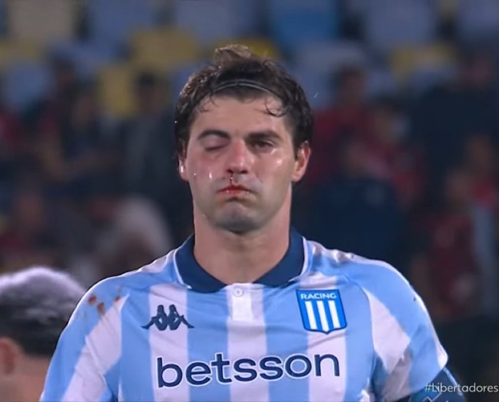 Santiago Sosa, do Racing, fratura o maxilar e será desfalque no jogo da ...