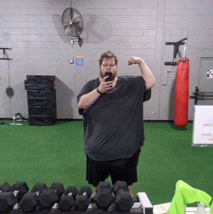 Homem perde 163 kg e luta contra excesso de pele: veja transformação em ...