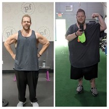 Homem perde 163 kg e luta contra excesso de pele: veja transformação em ...