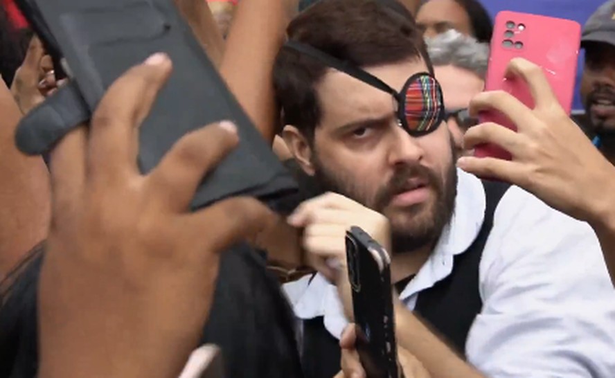 Entenda motivo do tapa-olho de Diogo Defante, que encerrou quadro com ...