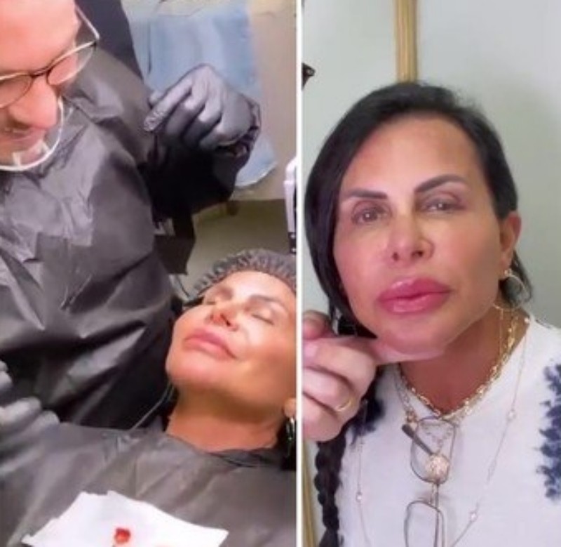 Gretchen: tecnologia estética para mudar o visual leva cantora à ...