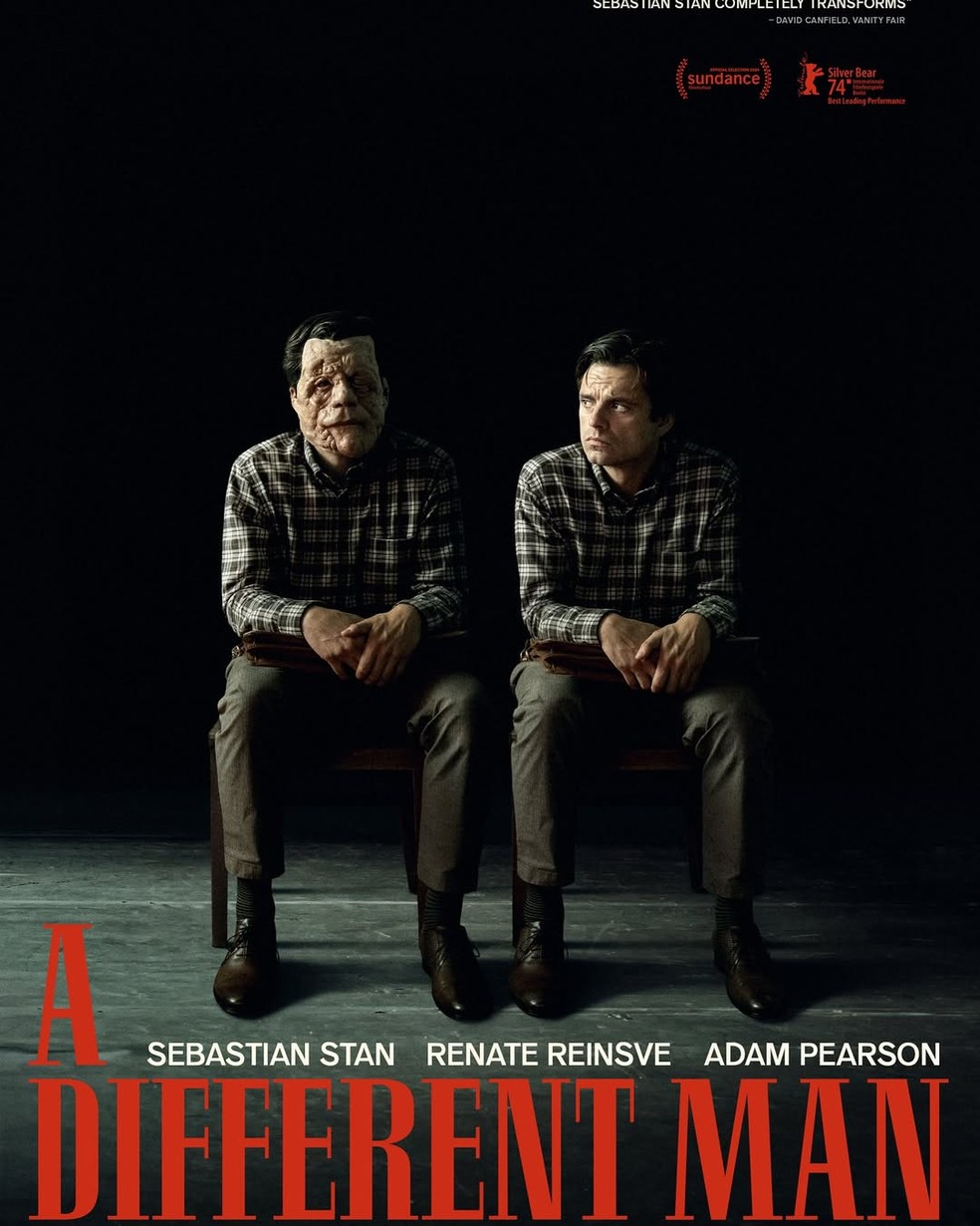 Quem é Adam Pearson, ator com neurofibromatose que foi ao Oscar e ...