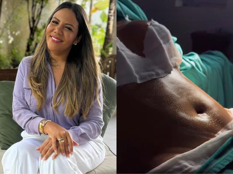 Mani Rego, ex de Davi Brito, mostra resultado de procedimentos ...