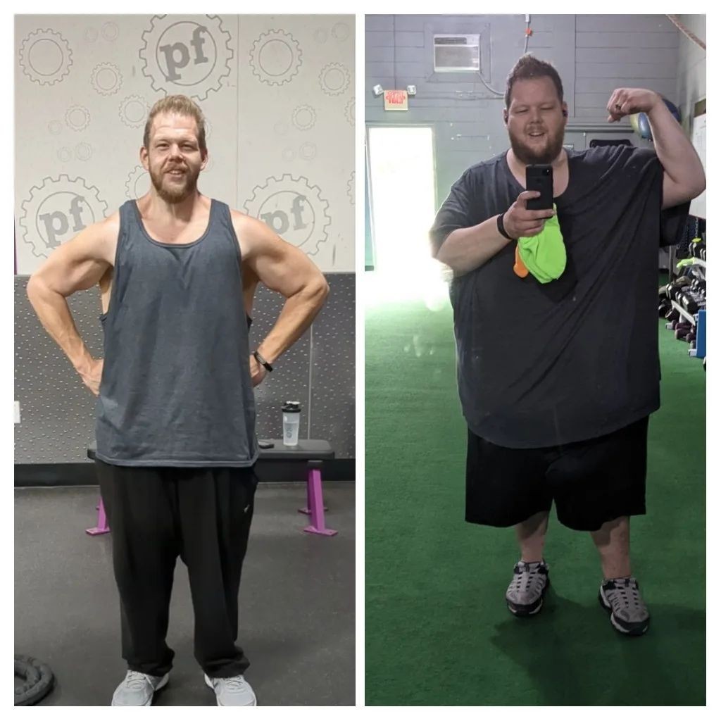 Homem perde 163 kg e luta contra excesso de pele: veja transformação em ...