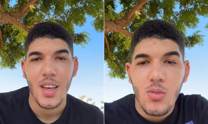 Síndrome de Patau: entenda a condição rara que acomete o filho caçula ...