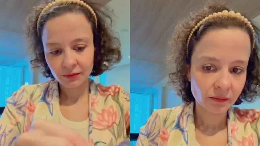 Maiara: entenda o que é alopecia androgenética, condição da cantora ...
