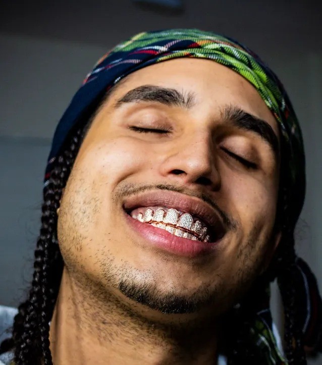 'Grillz' e piercings dentais voltam à moda; veja famosos que aderiram ...