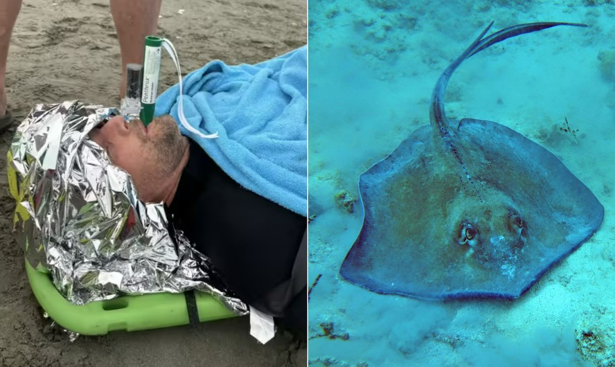 Homem sobrevive 'milagrosamente' a ataque de arraia durante treinamento ...