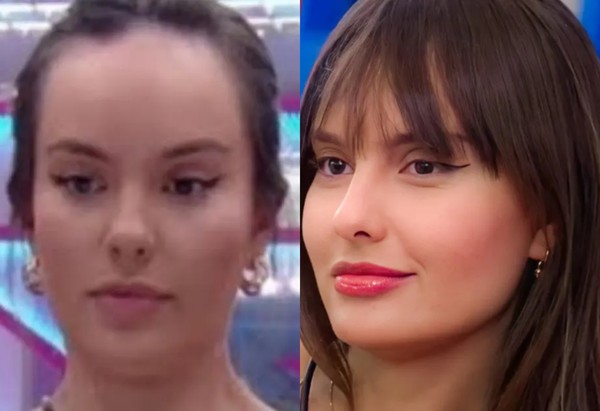 Ex-BBB Thais Braz detalha cirurgia para redução da testa e mostra ...