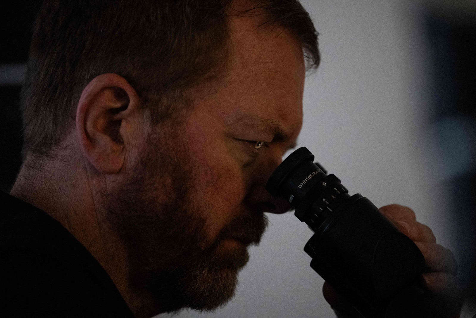 Paciente retira rim de porco transplantado após período recorde de ...