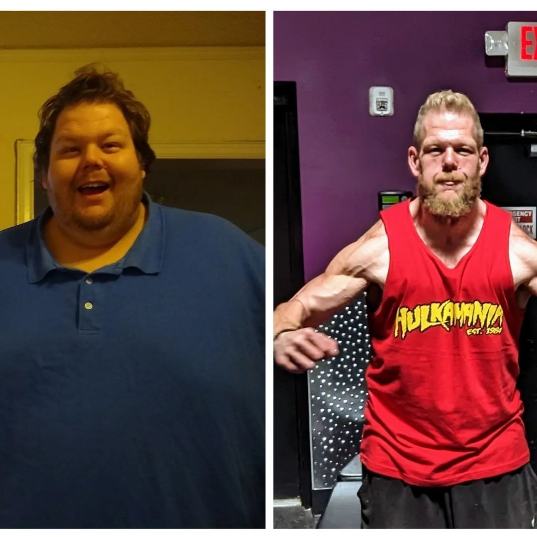 Homem perde 163 kg e luta contra excesso de pele: veja transformação em ...