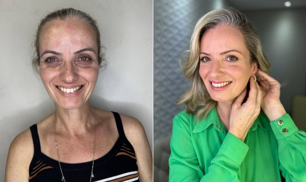 Peeling de fenol: tratamento viraliza após morte de empresário em ...