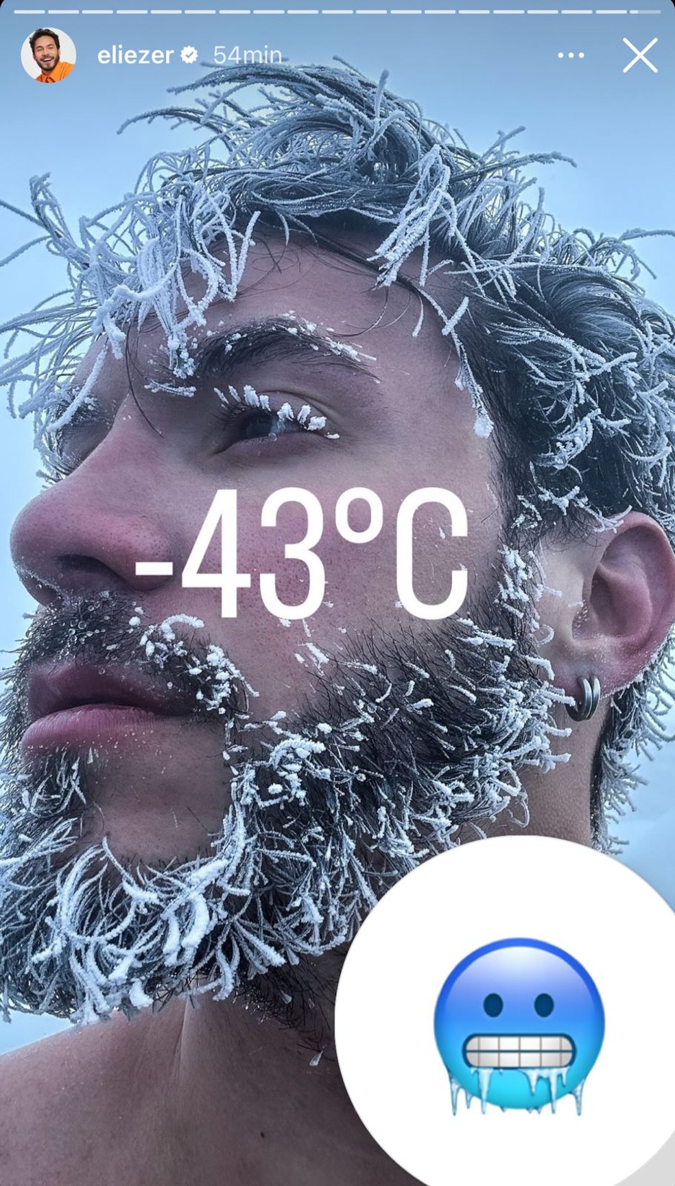 Eliezer fica com o rosto congelado no frio de -43 graus do Alasca: 'O verdadeiro nevou'