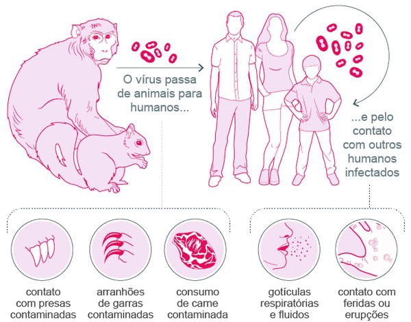 Varíola dos macacos: dos sintomas ao tratamento, tudo que você precisa ...