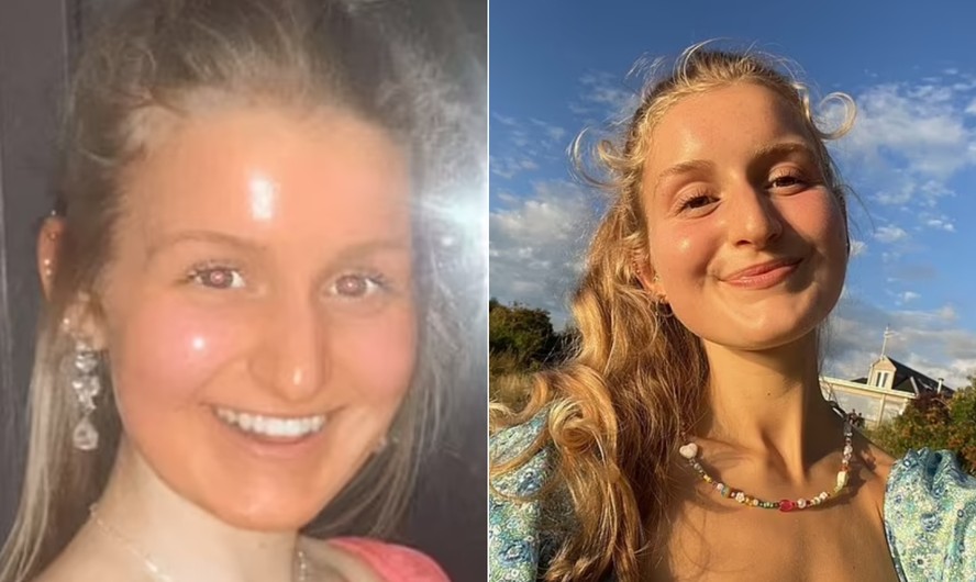 ‘Pareço um Oompa Loompa’, diz jovem que ficou laranja após comer ...