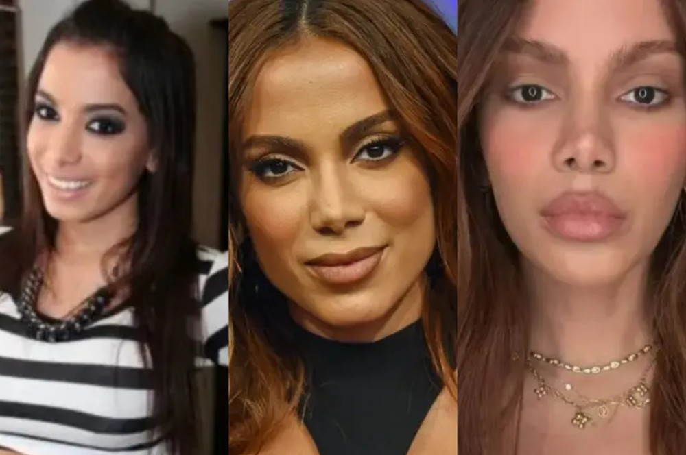 Anitta: saiba como procedimentos no rosto impactaram o novo projeto da ...
