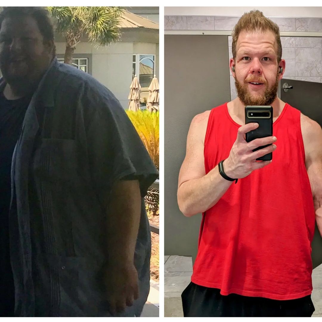 Homem perde 163 kg e luta contra excesso de pele: veja transformação em ...