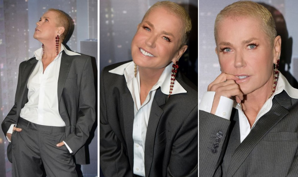 Veja antes e depois de Xuxa após fazer 80 procedimentos dermatológicos ...