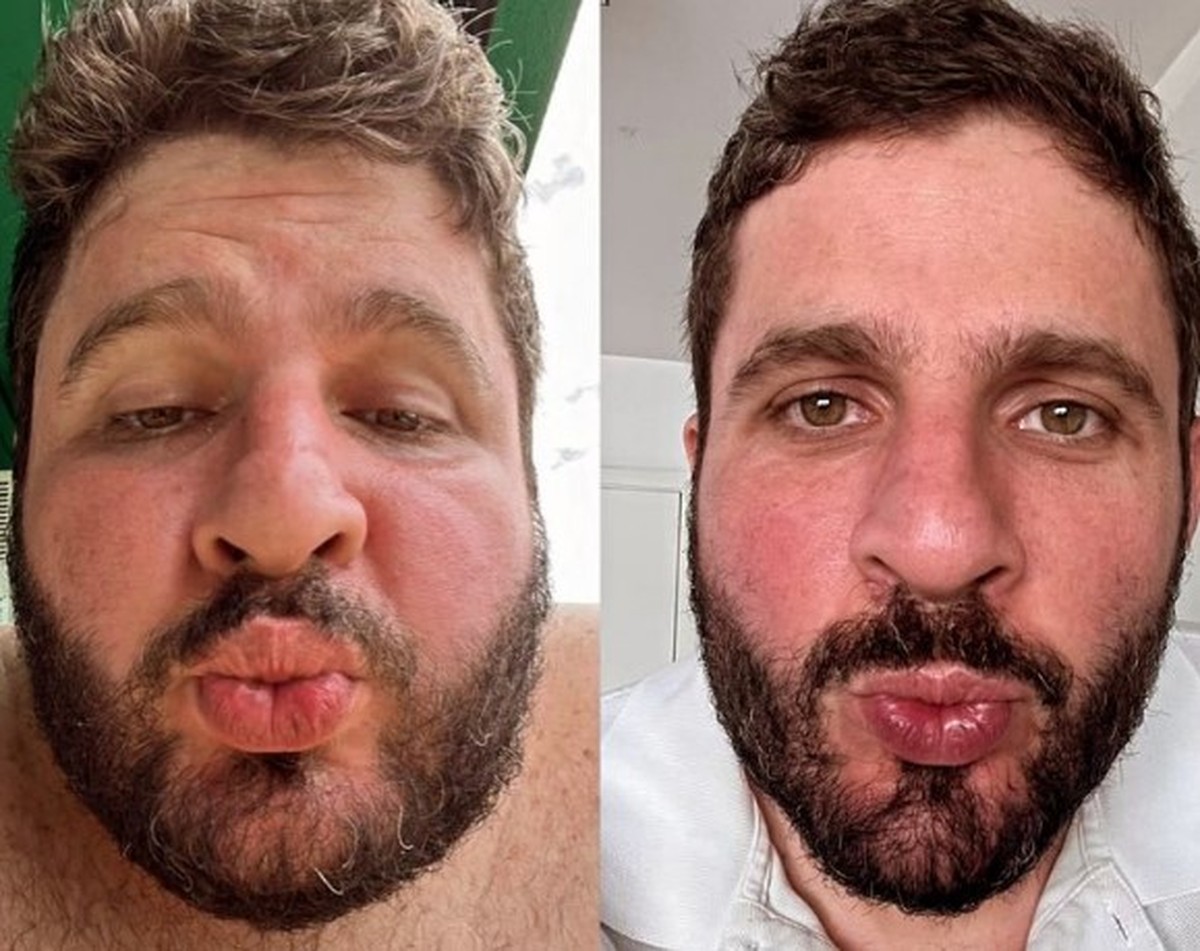 Ex-participante do 'MasterChef' perde 80 kg e mostra antes e depois ...