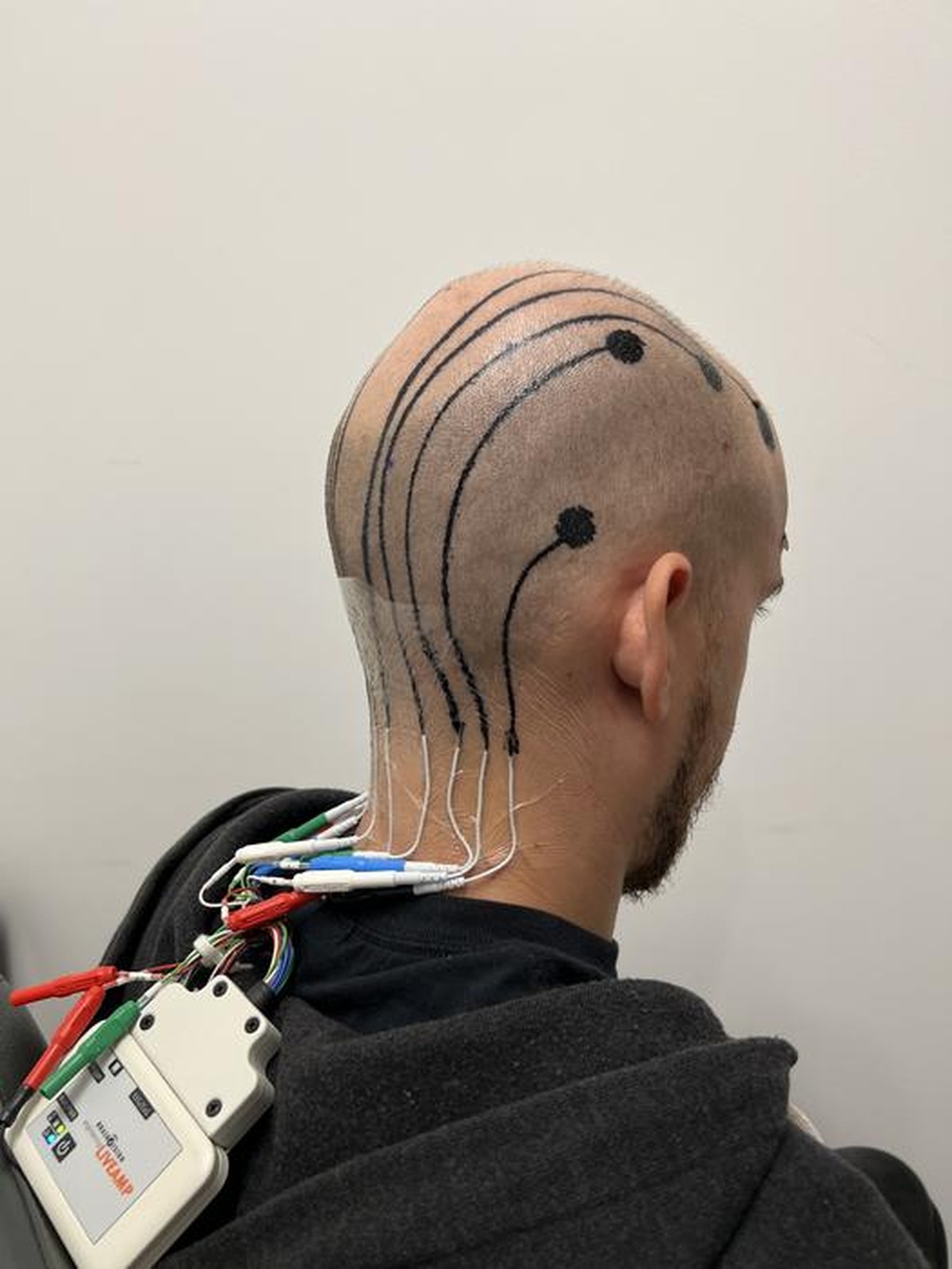 Novas 'e-tattoos' captam a atividade cerebral através do crânio; entenda