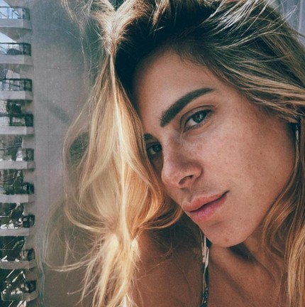 Paralisia de Bell: entenda a condição que paralisou metade do rosto da ...