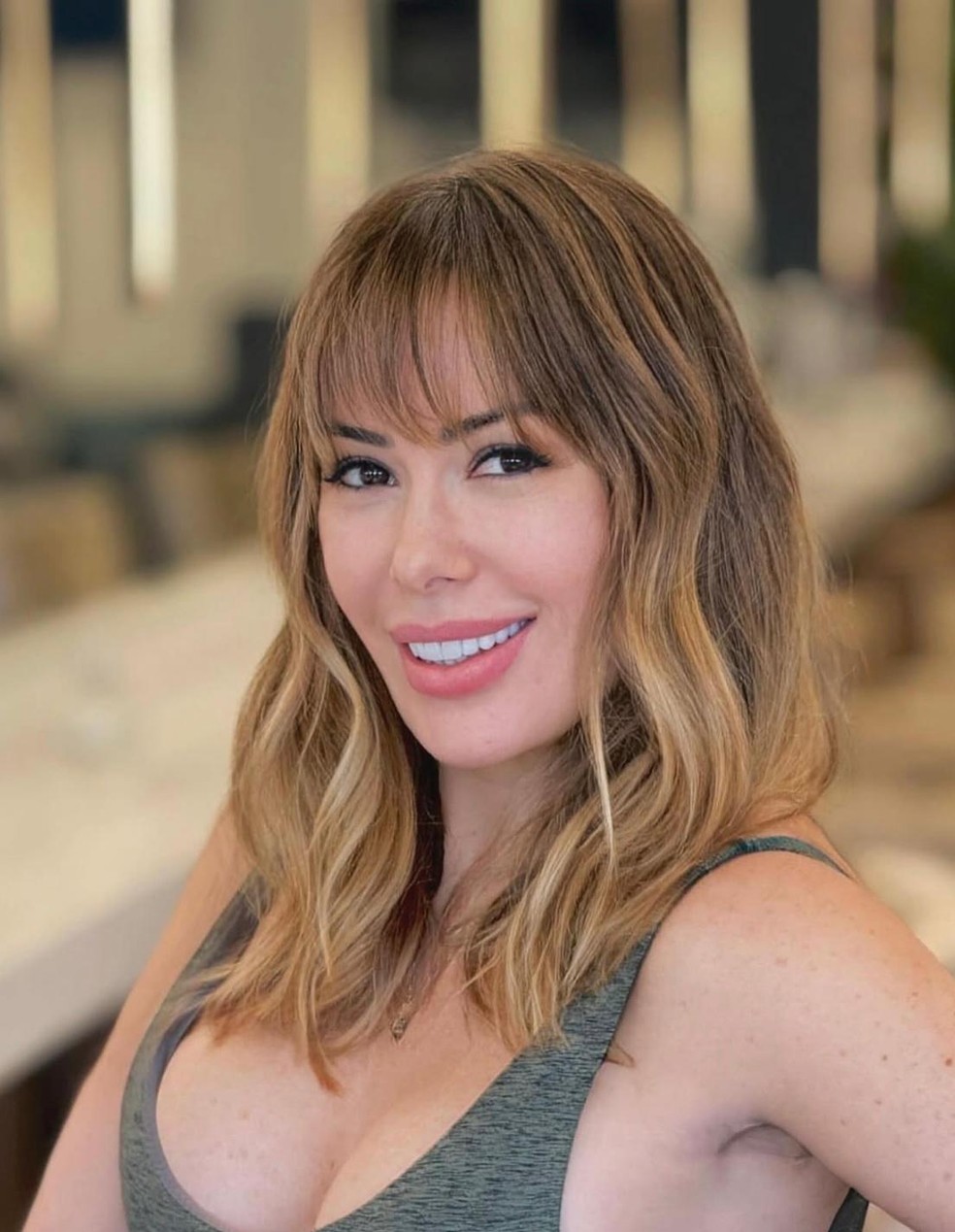 Influenciadora brasileira segue com sequelas após mordida do cachorro no México: 'Achei que ...