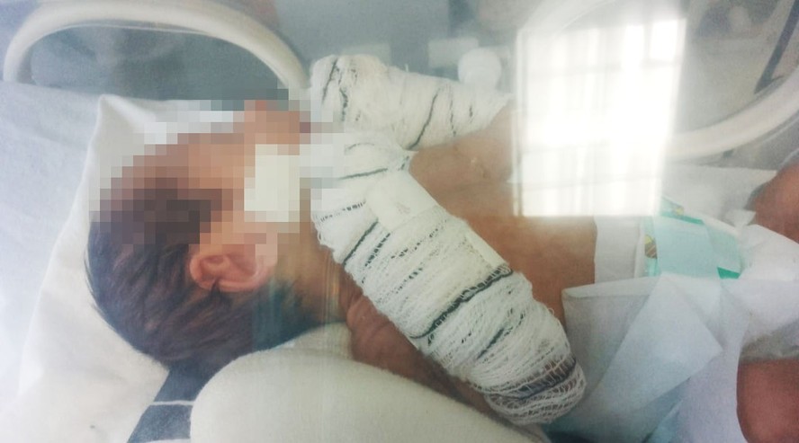 Pai diz que filho recém-nascido terá de amputar dedos devido a infecção ...